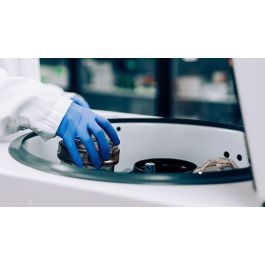 Protocol for Reducing Cell Clumping in Single Cell Suspensions ...