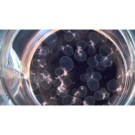 How to Extract CSF-Like Fluid from Choroid Plexus Organoids