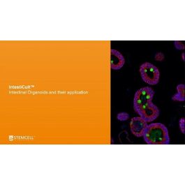 Intestinal Organoids: Improved Tools and In Vitro Models for Drug ...